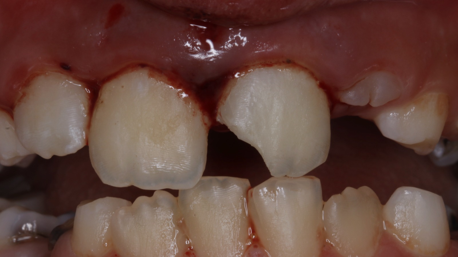 Prevention and Emergency Care – International Association of Dental ...