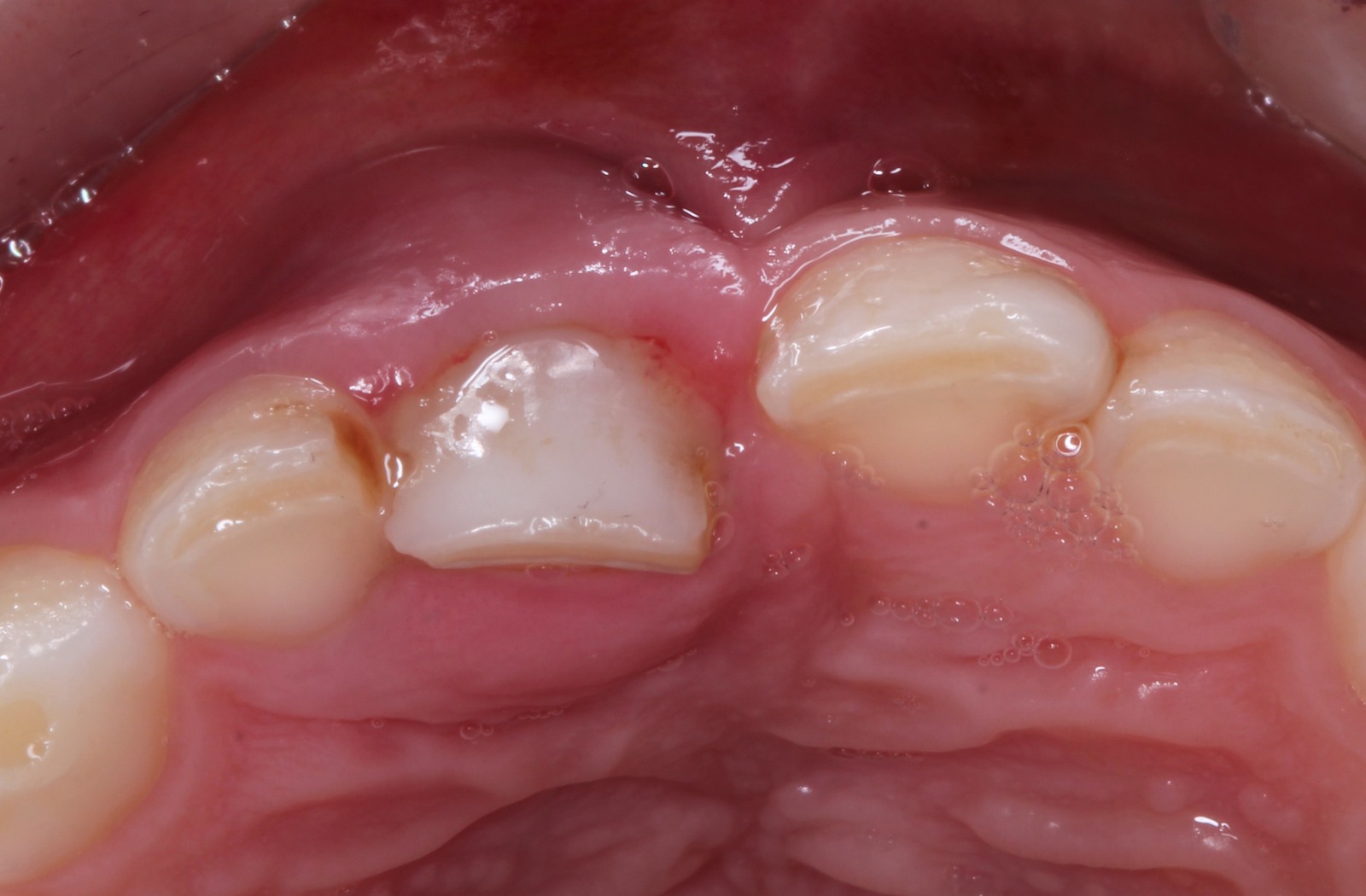 Prevention and Emergency Care – International Association of Dental ...